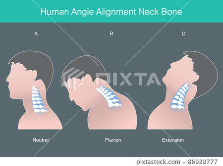 Human angle alignment neck bone. Human neck...-插圖素材 [86928777] - PIXTA圖庫