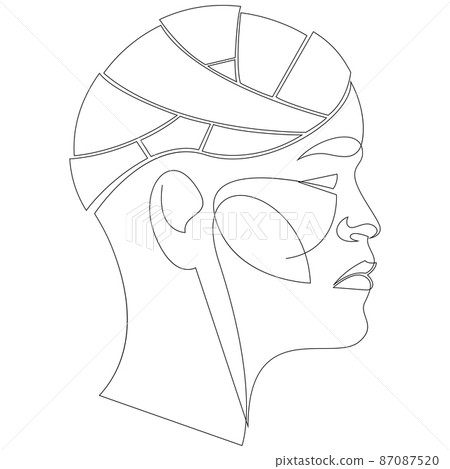 Memory loss and dementia, brain damage concept.... - Stock Illustration ...