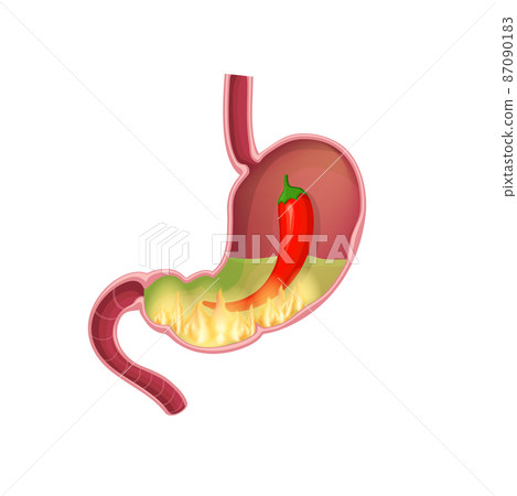 Stomach with red pepper fire, gas and gastric acid - Stock Illustration ...