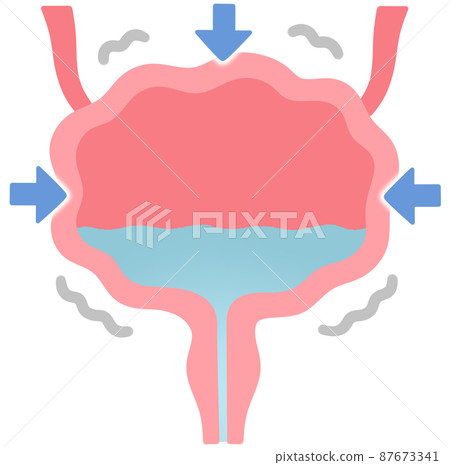 Overactive bladder - Stock Illustration [87673341] - PIXTA