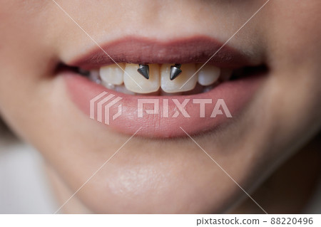 Upper Frenulum Piercing Smiley Piercing: Pictures, Pros, Cons,