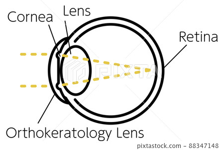 Illustration of vision correction lens and... - Stock Illustration ...