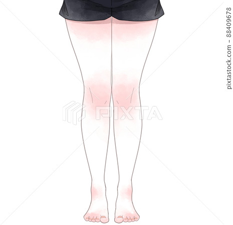 Fat fat woman legs - Stock Illustration [88409678] - PIXTA