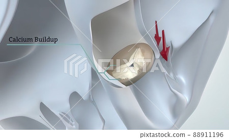 The Heart anatomy. 3D Medical of Aortic Valve - Stock Illustration ...