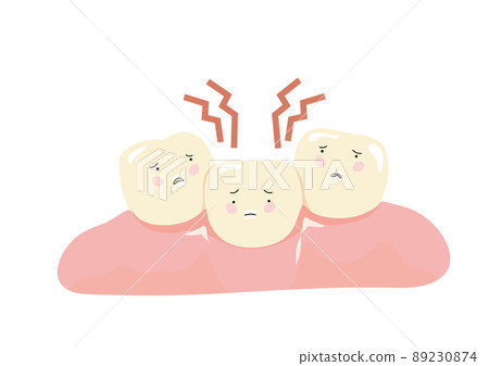 20220427516 Teeth with poor alignment - Stock Illustration [89230874 ...