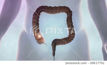 Colonoscopy is the visualization of the large... - Stock Illustration ...