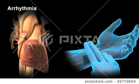 Cardiac Conduction System 3d medical - Stock Illustration [89758669 ...
