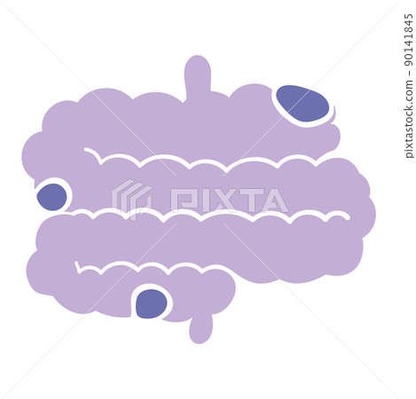 Tumored intestine - Stock Illustration [90141845] - PIXTA