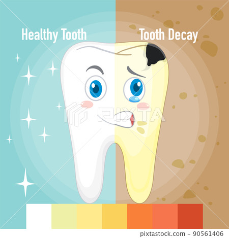 Infographic of healthy tooth and tooth decay - Stock Illustration ...