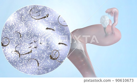 Female reproductive organ, sperm entering the... - Stock Illustration ...
