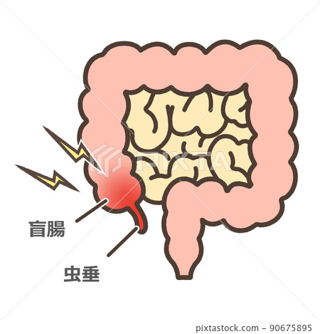 Illustrated illustration of the cecum - Stock Illustration [90675895 ...