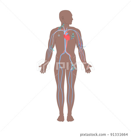 Central line venous catheter types on male body - Stock Illustration ...