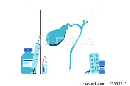 gallbladder anatomy poster - Stock Illustration [91935741] - PIXTA