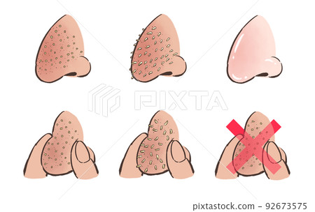 Illustration of nose plug - Stock Illustration [92673575] - PIXTA