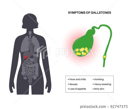 Gallbladder Stones Symptoms A Complete Guide To Gallstones: Formation
