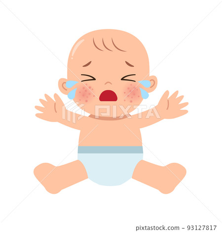 Baby having eczema skin problem on face. Flat... - Stock Illustration ...