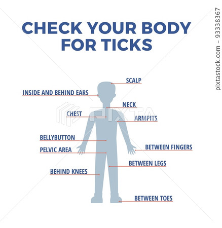Infographic about check your body for ticks...-插圖素材 [93338367] - PIXTA圖庫