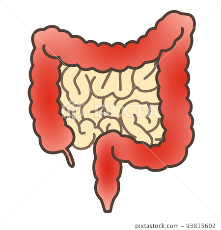 Ulcerative colitis - Stock Illustration [93815602] - PIXTA