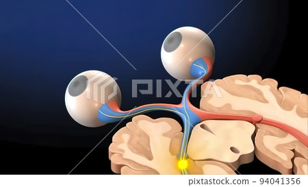 Medical 3D illustration of The Lateral... - Stock Illustration ...