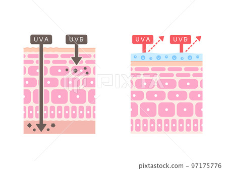 Illustration of skin structure UV damage to... - Stock Illustration ...