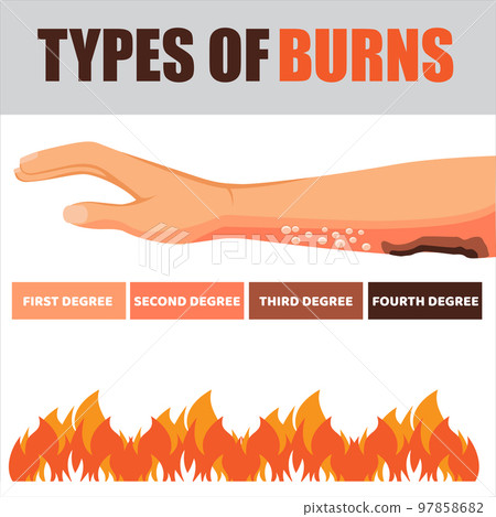 Burn Injury Clipart