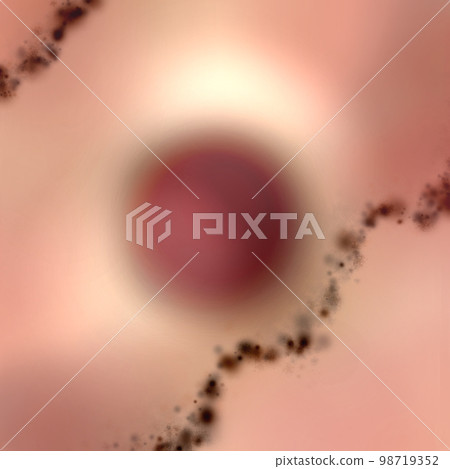 Pulsating bleeding illustration (2) - Stock Illustration [98719352] - PIXTA
