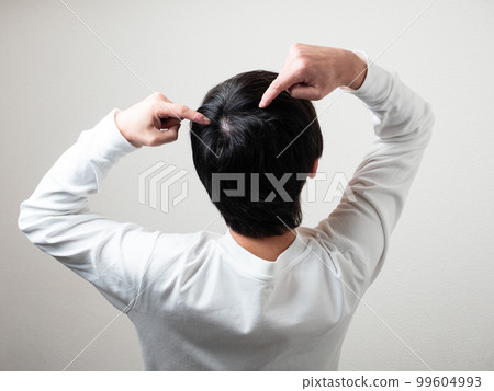 Male occipital hair whirlpool - Stock Photo [99604993] - PIXTA