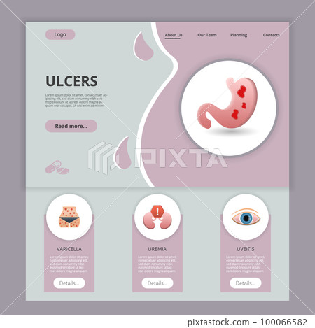 Ulcers flat landing page website template....-插圖素材 [100066582] - PIXTA圖庫