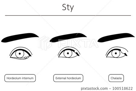 Medical illustration, line drawing illustration... - Stock Illustration ...