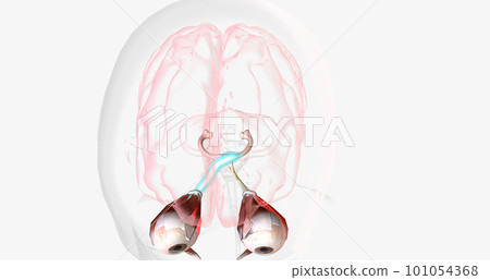 Strabismic Amblyopia, Visual Pathway with Eye... - Stock Illustration ...