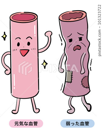 healthy and weak blood vessels - Stock Illustration [101323722] - PIXTA