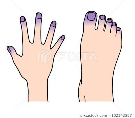 cyanosis - Stock Illustration [102342897] - PIXTA