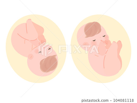 Womb image of normal and breech baby without... - Stock Illustration ...