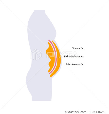 Visceral fat diagram - Stock Illustration [104436230] - PIXTA