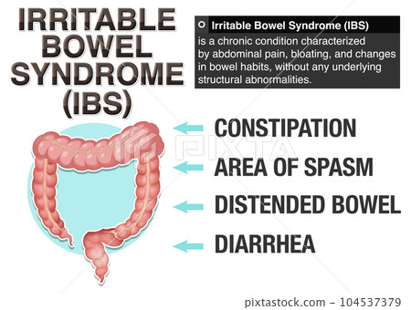 Ibs Infographic Infographics To Share With Your Patients! | Content