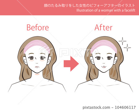A before and after illustration of a woman who... - Stock Illustration ...
