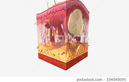 The Sebaceous Cyst Tissue Detail - Stock Illustration [104840095] - PIXTA