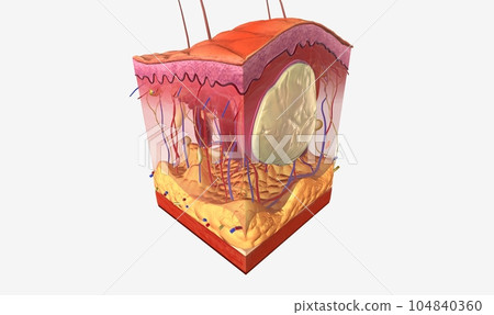 The Sebaceous Cyst Tissue Detail - Stock Illustration [104840360] - PIXTA
