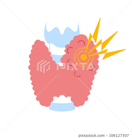 Thyroid gland with goiter body organ icon - Stock Illustration ...