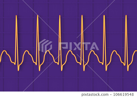 ECG in atrial flutter, 3D illustration - Stock Illustration [106619548 ...