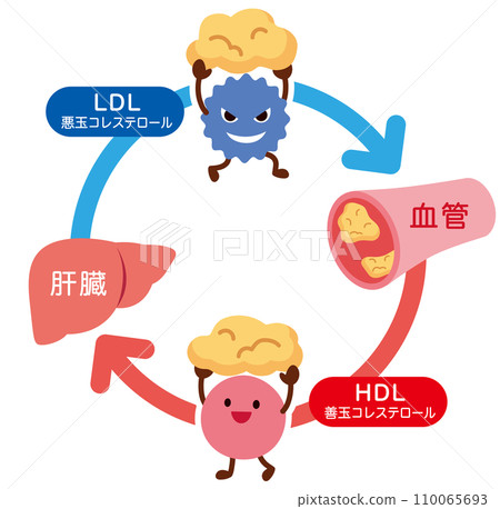 Mechanism of LDL and HDL Dyslipidemia Blood... - Stock Illustration ...