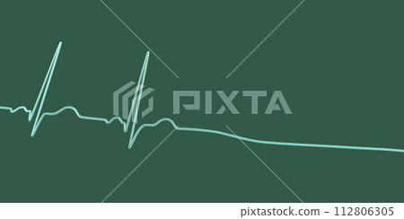 ECG in asystole, 3D illustration - Stock Illustration [112806305] - PIXTA