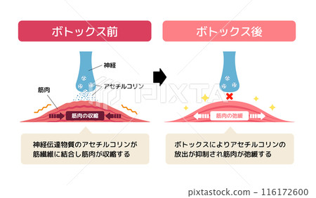 Mechanism of muscle relaxation by Botox... - Stock Illustration ...
