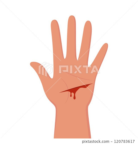 Bleeding cut on the palm, emergency situation.... - Stock Illustration ...
