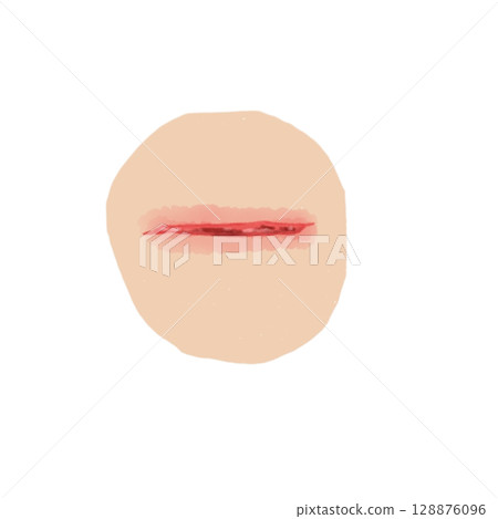 Laceration | Lacerated skin wound illustration... - Stock Illustration ...